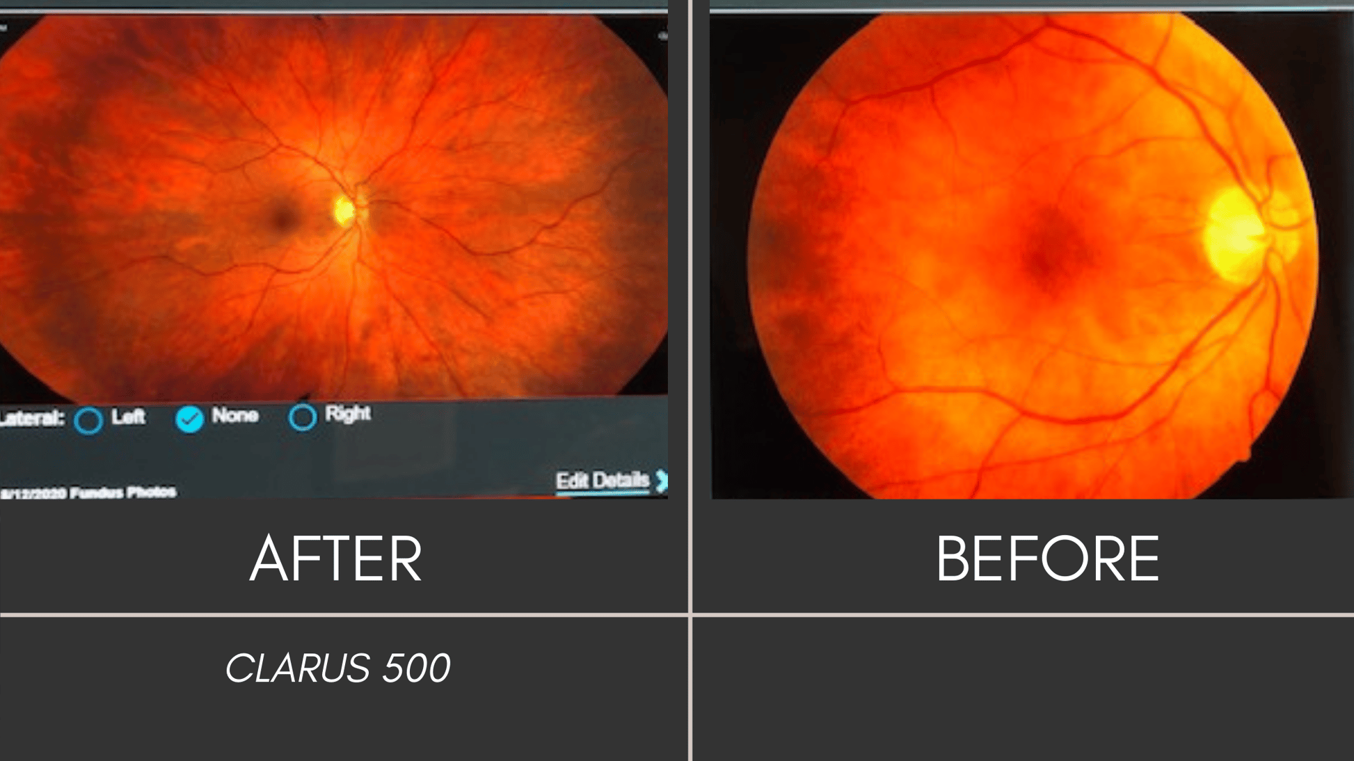 The ZEISS Clarus 500 - Our New Imaging System